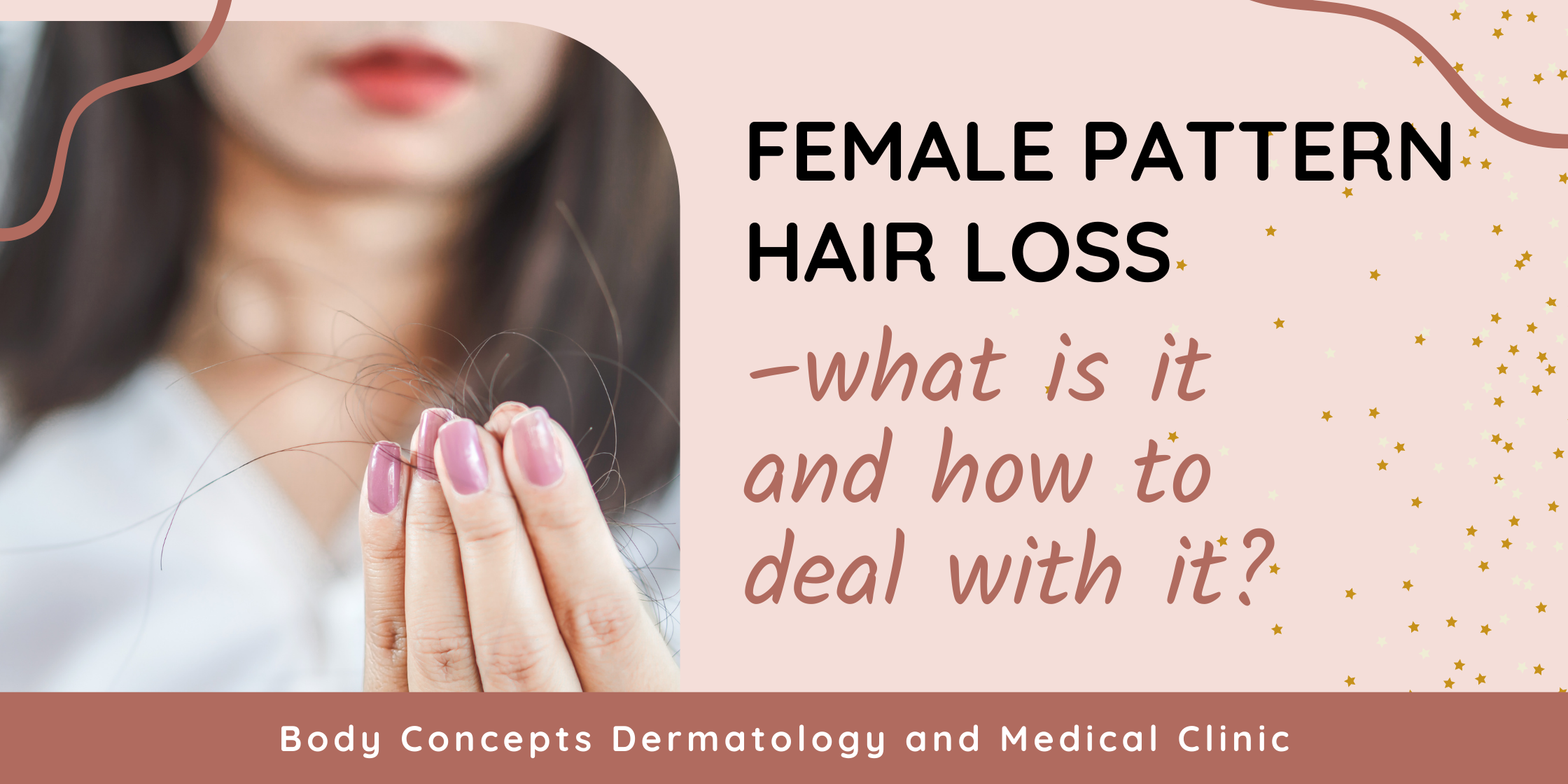Female pattern hair loss –what is it and how to deal with it?